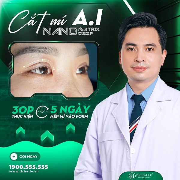 Cắt mí AI - Nano Matrix Deep có gì khác so với các phương pháp cắt mí truyền thống?