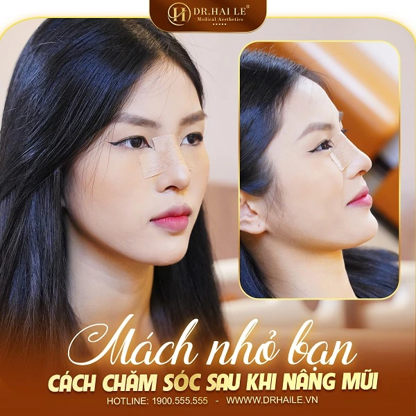 Bật mí cách chăm sóc sau nâng mũi