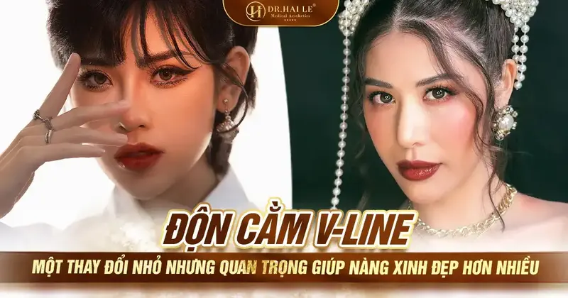 Độn cằm V-line - Một thay đổi nhỏ nhưng quan trọng giúp nàng xinh đẹp hơn nhiều