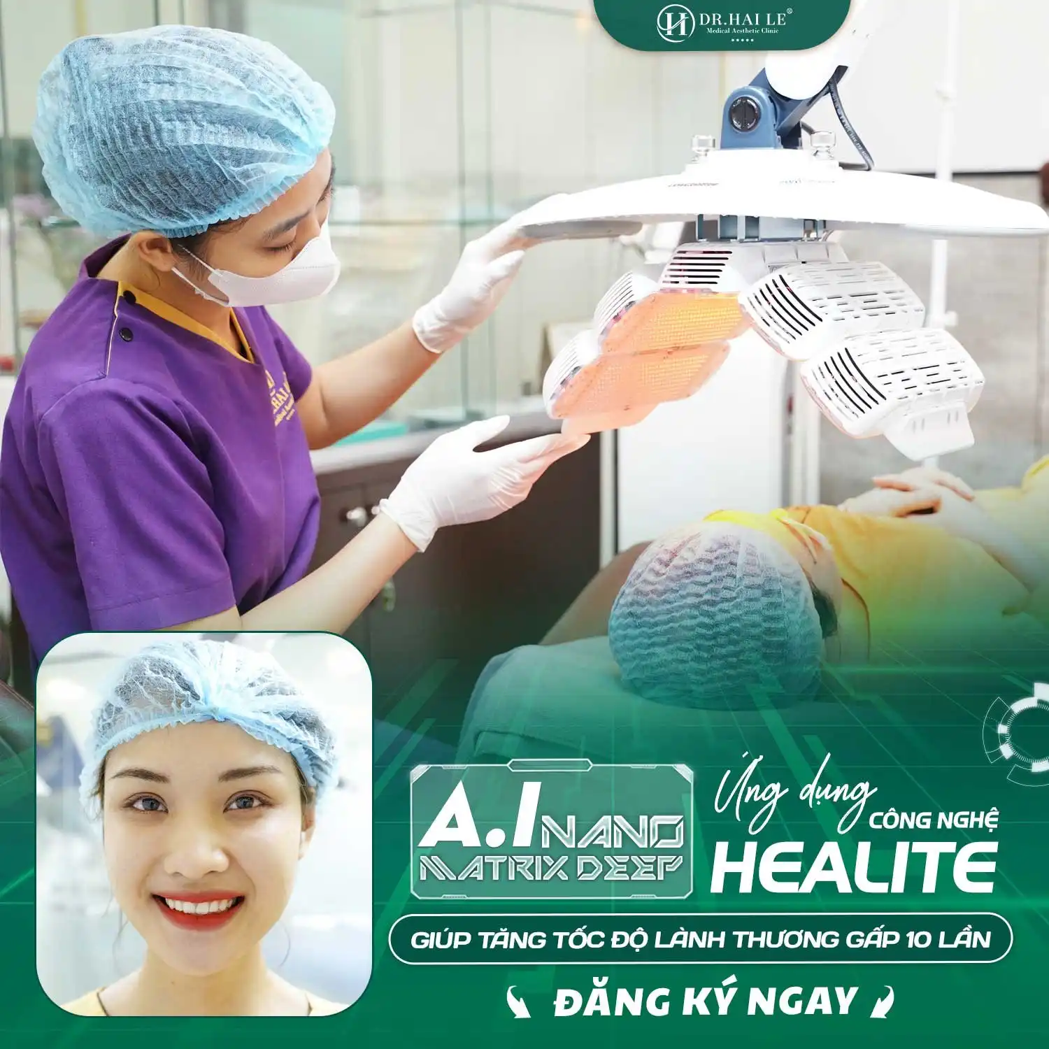 Cắt mí A.I Nano matrix Deep